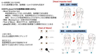 めまいのヒントは”HINTS plus” にあり【動画付き】 - 救急医の頭ん中。